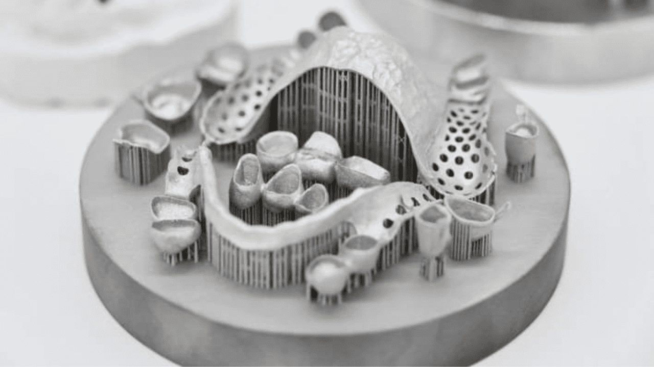 Dental Implant Additive Manufacturing At Kimberly Clifton Blog